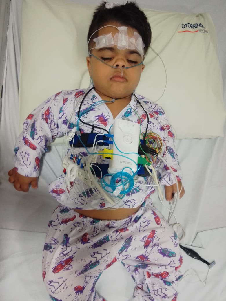 Qual é a importância da polissonografia na infância? - INN - Instituto Nacional de Nanismo